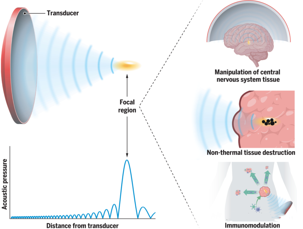 FUS无创地在体内深处产生生物效应